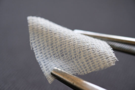 Amniotic Membrane in Regenerative Medicine: Properties and Research