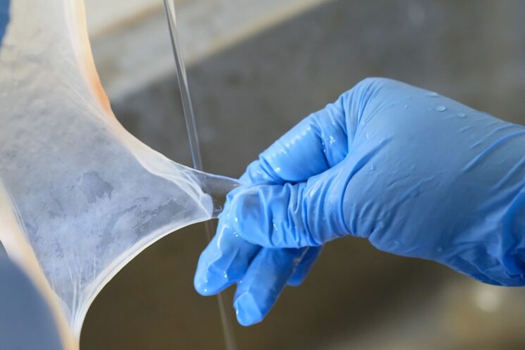 Amniotic Membrane Transplant Products for Surgical Wound Care