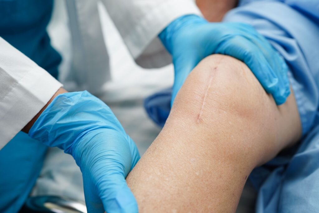Regenerative medicines for Surgical Wound Care
